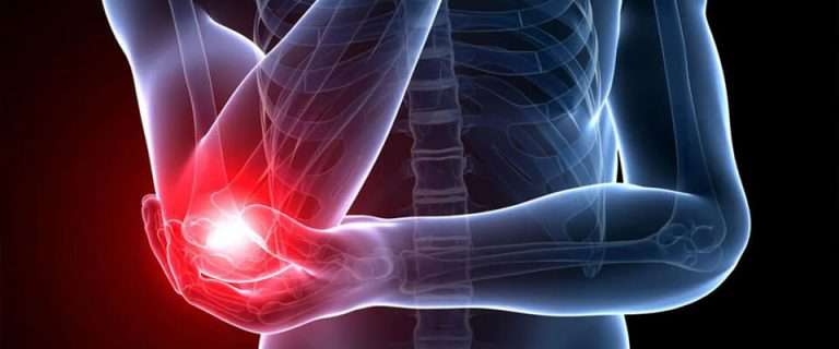 What are the 5 Most Common Elbow Injuries? - BioXcellerator