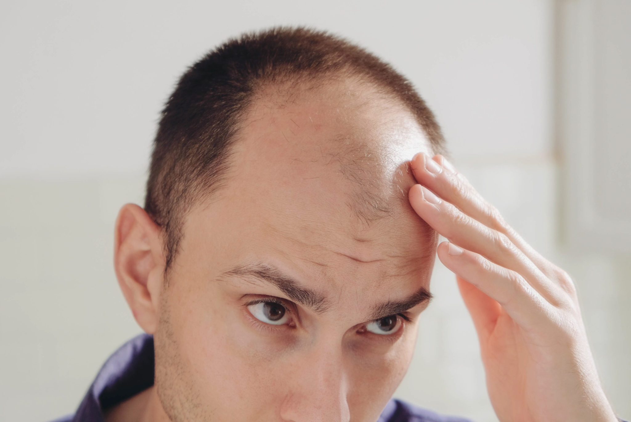 Unlock Full Hair Regrowth Now! Stem Cells Are Revolutionizing Hair Loss ...