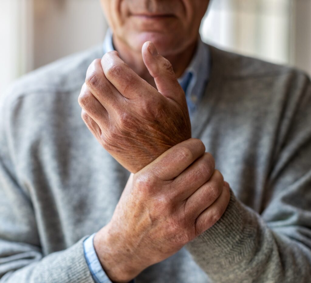 Discover Your Options for Wrist Sprains and Tears - BioXcellerator